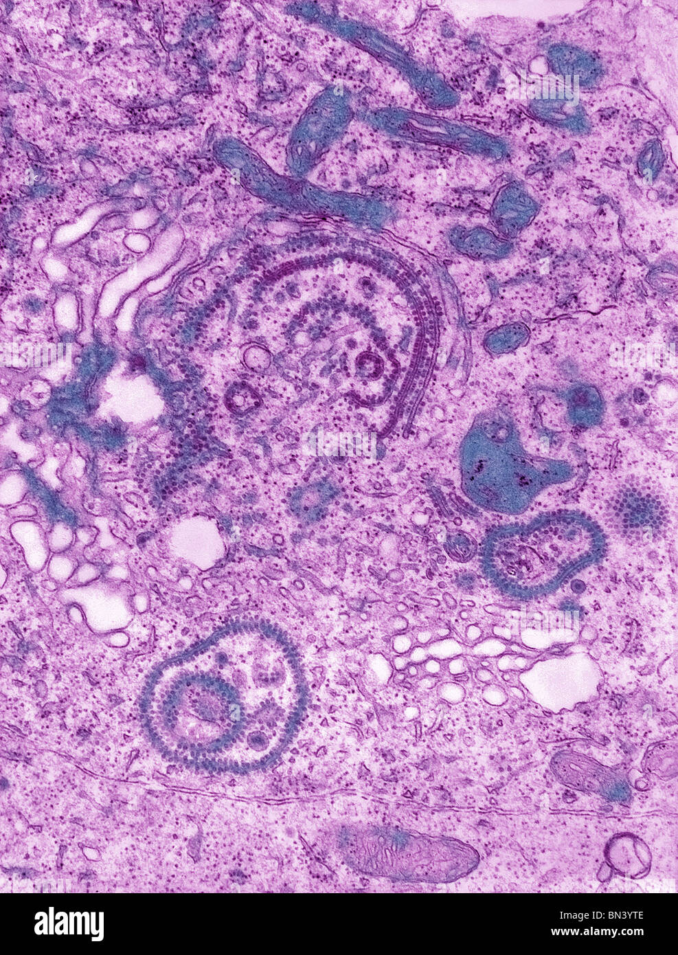 Transmission electron micrograph (TEM) of Eastern Equine Encephalitis ...