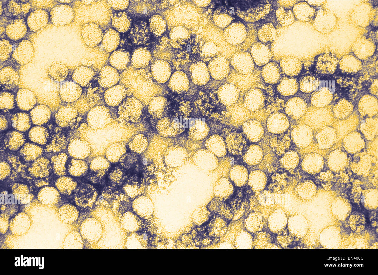 Transmission electron microscope color enhanced hi-res stock ...
