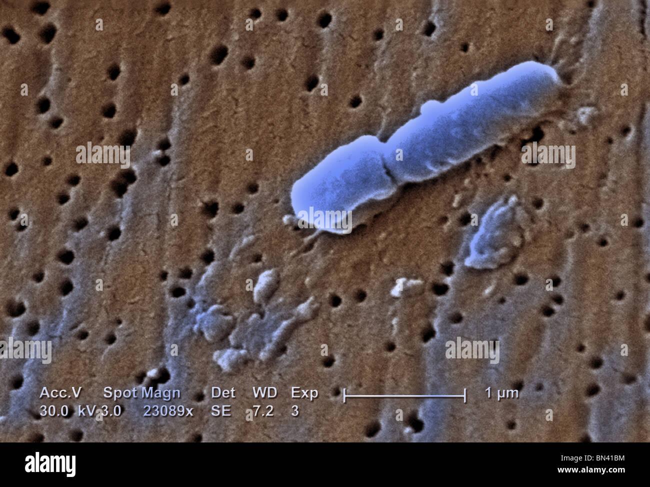 Klebsiella pneumoniae hi-res stock photography and images - Alamy