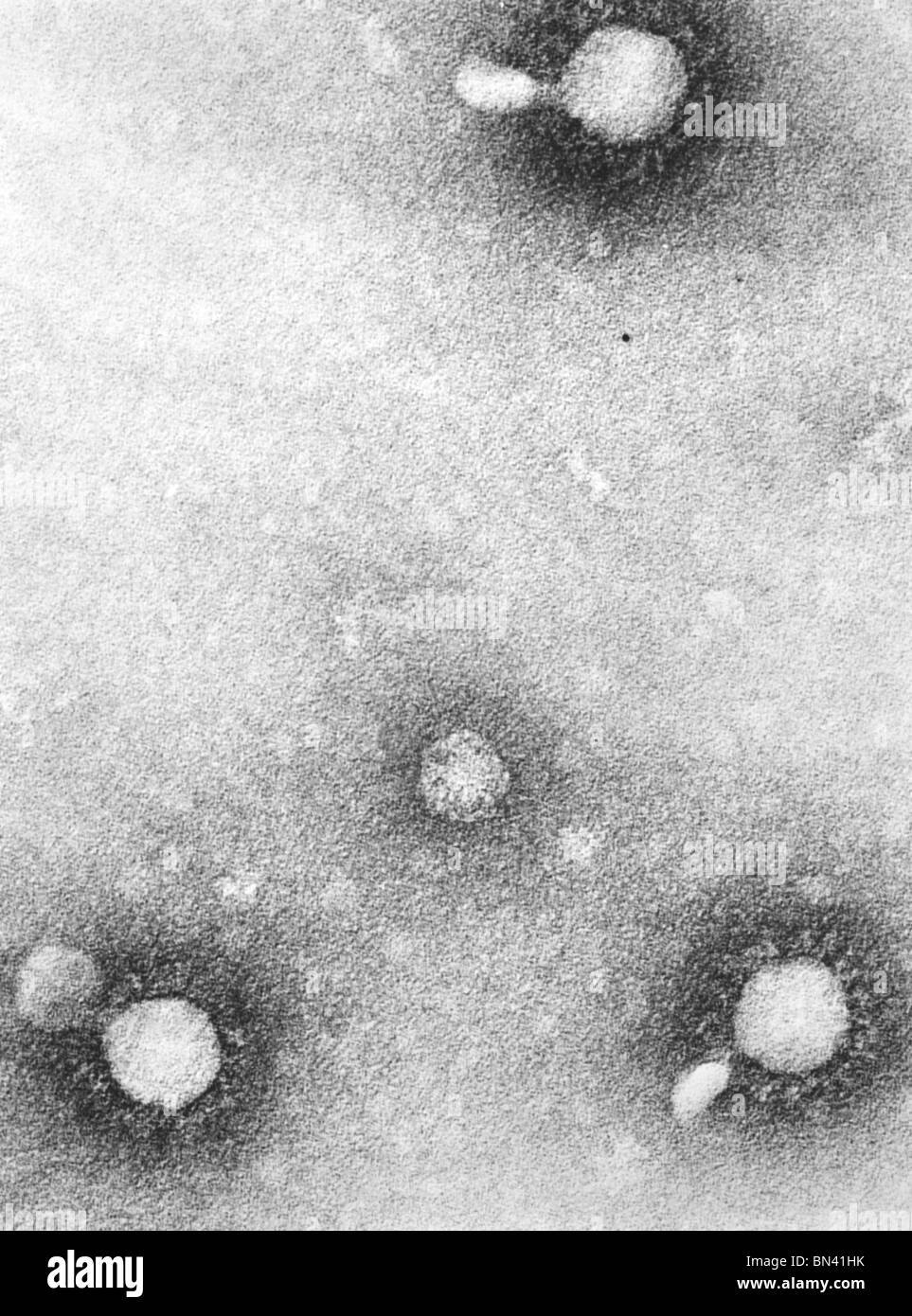 Negatively-stained transmission electron micrograph (TEM) of Venezuelan ...