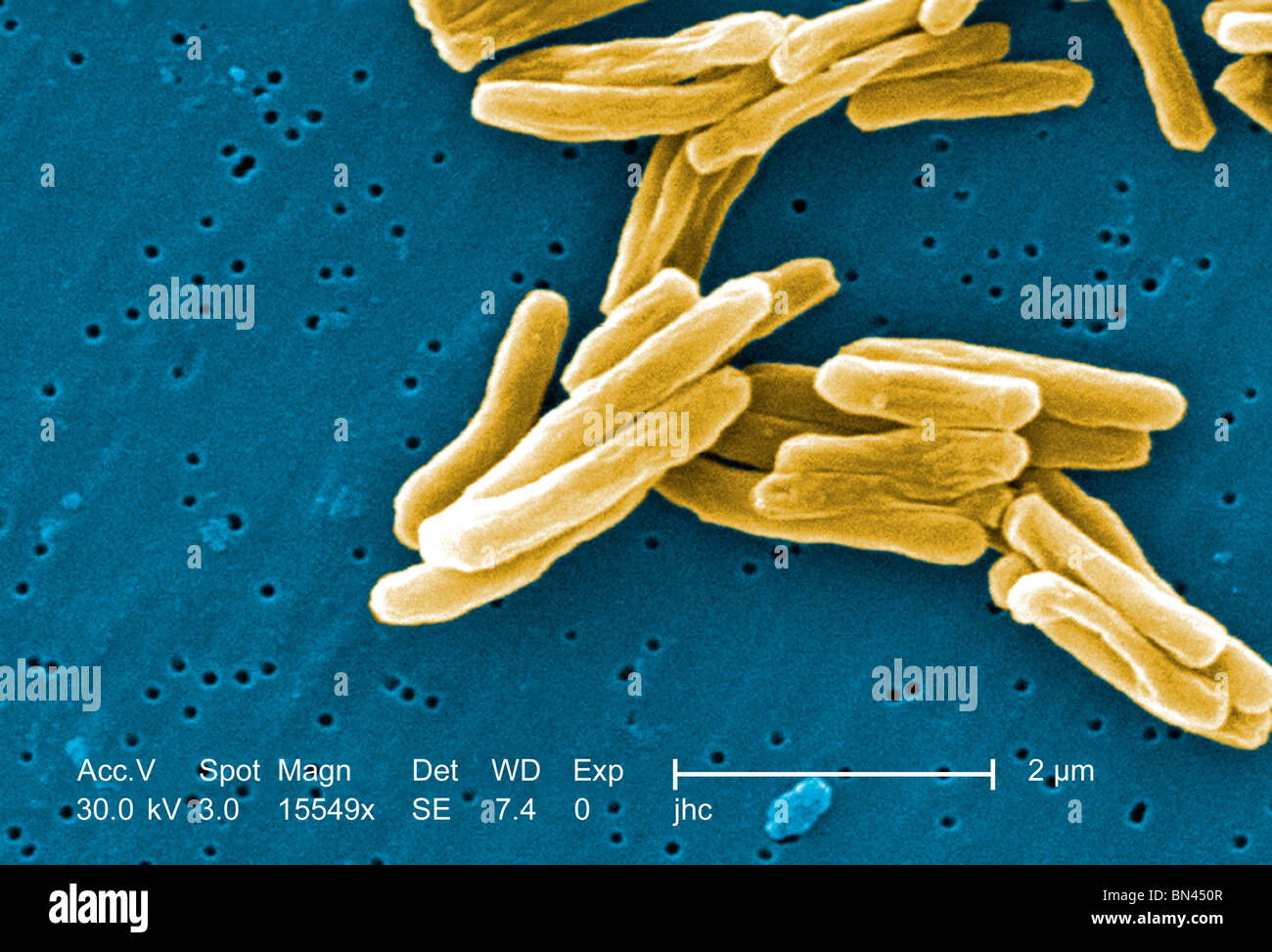 Mycobacterium tuberculosis sem hi-res stock photography and images - Alamy