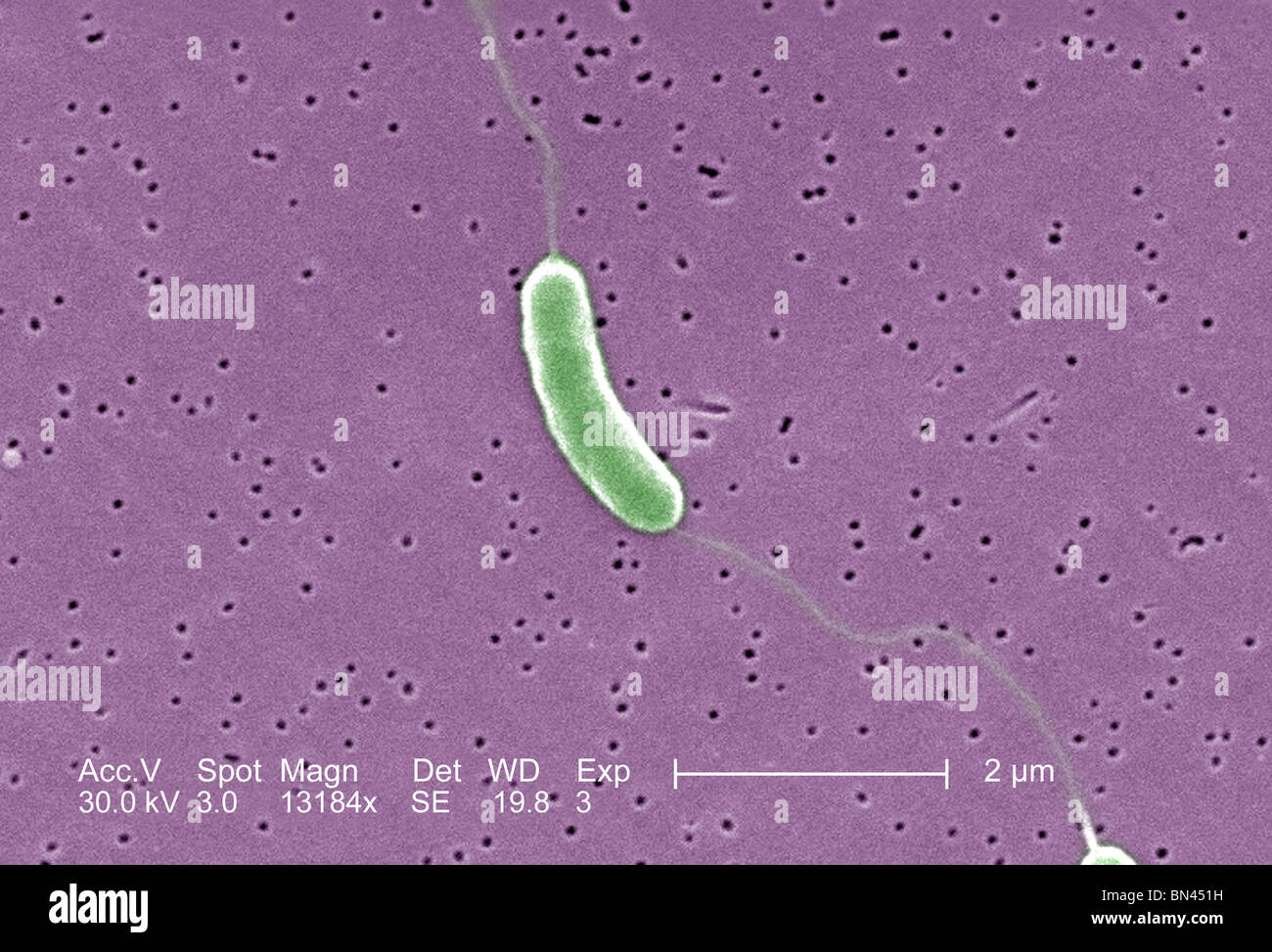 Vibrio High Resolution Stock Photography and Images - Alamy