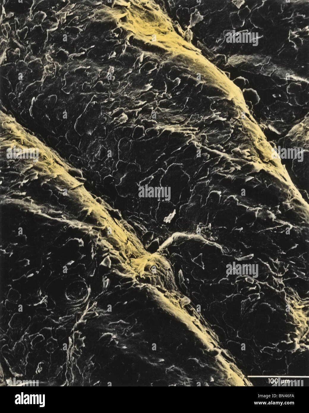 Human skin, colorized scanning electron microscope image Stock Photo ...