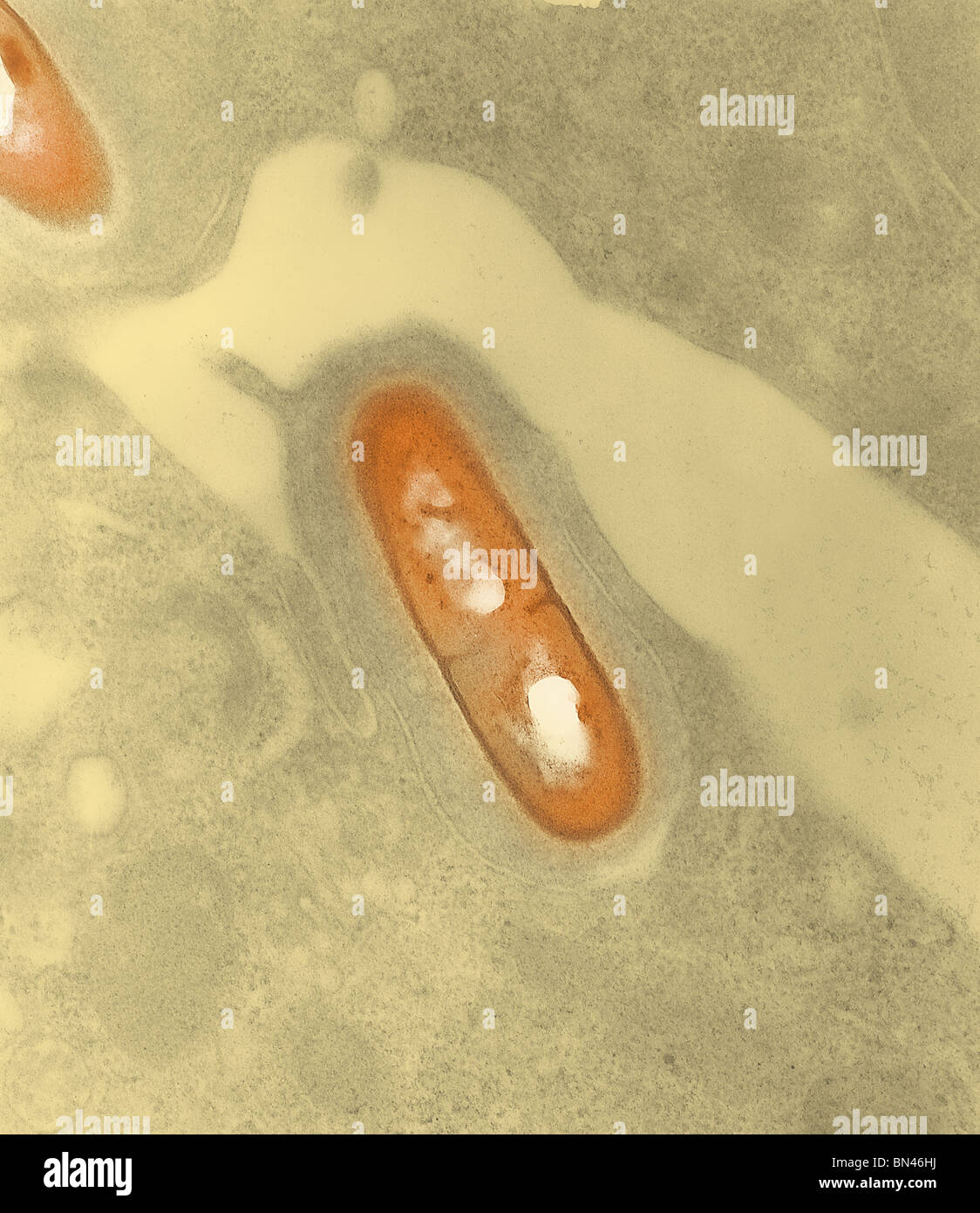 Listeria monocytogenes hi-res stock photography and images - Alamy