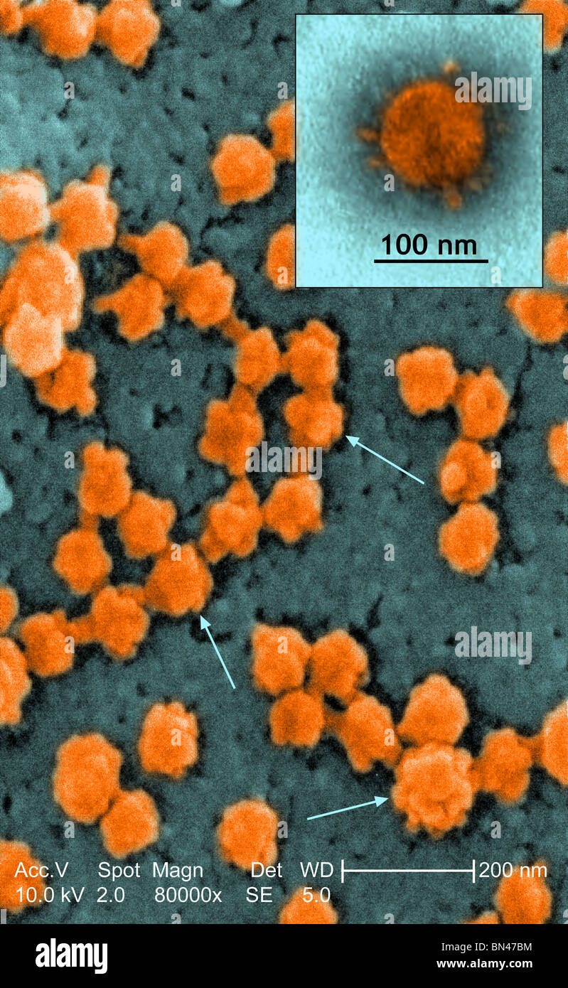 Colorized scanning electron micrograph (SEM) showing the “rosette-like ...