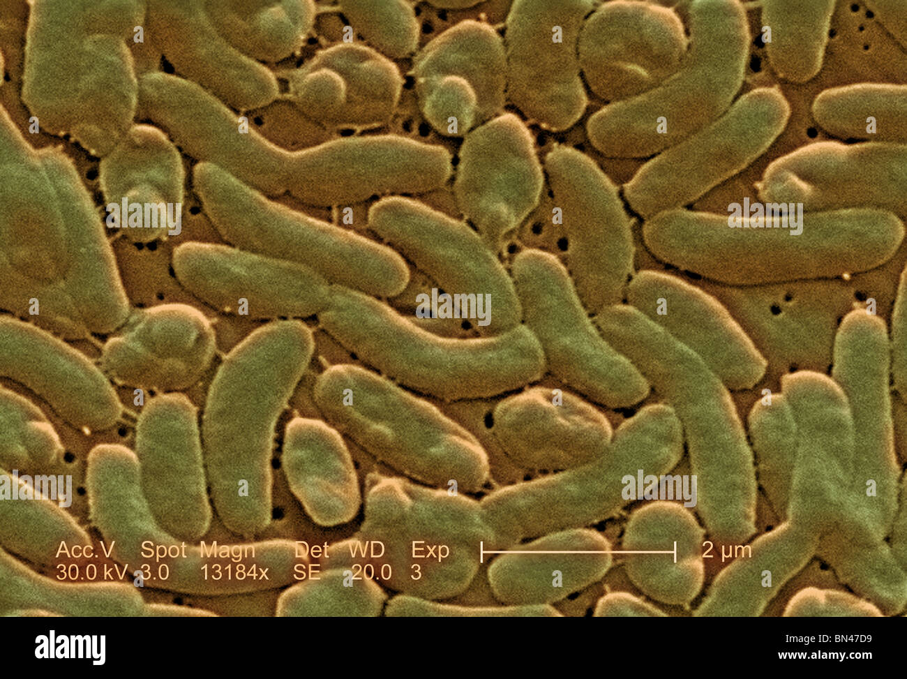 Bacteria vibrio vulnificus hi-res stock photography and images - Alamy