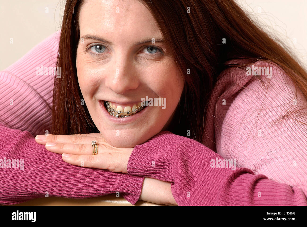 Protruding teeth hi-res stock photography and images - Alamy