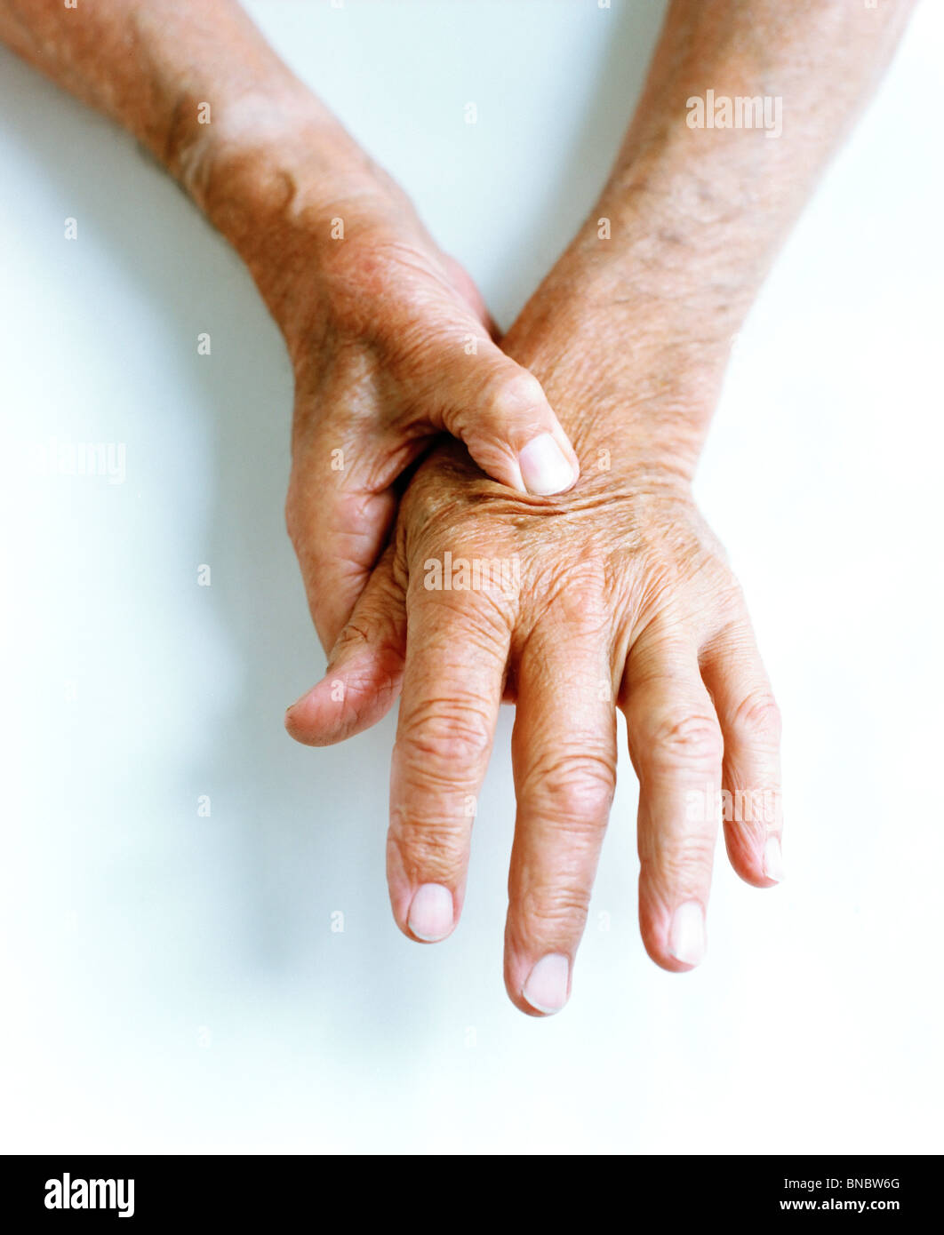 Rheumatoid arthritis hands hi-res stock photography and images - Alamy