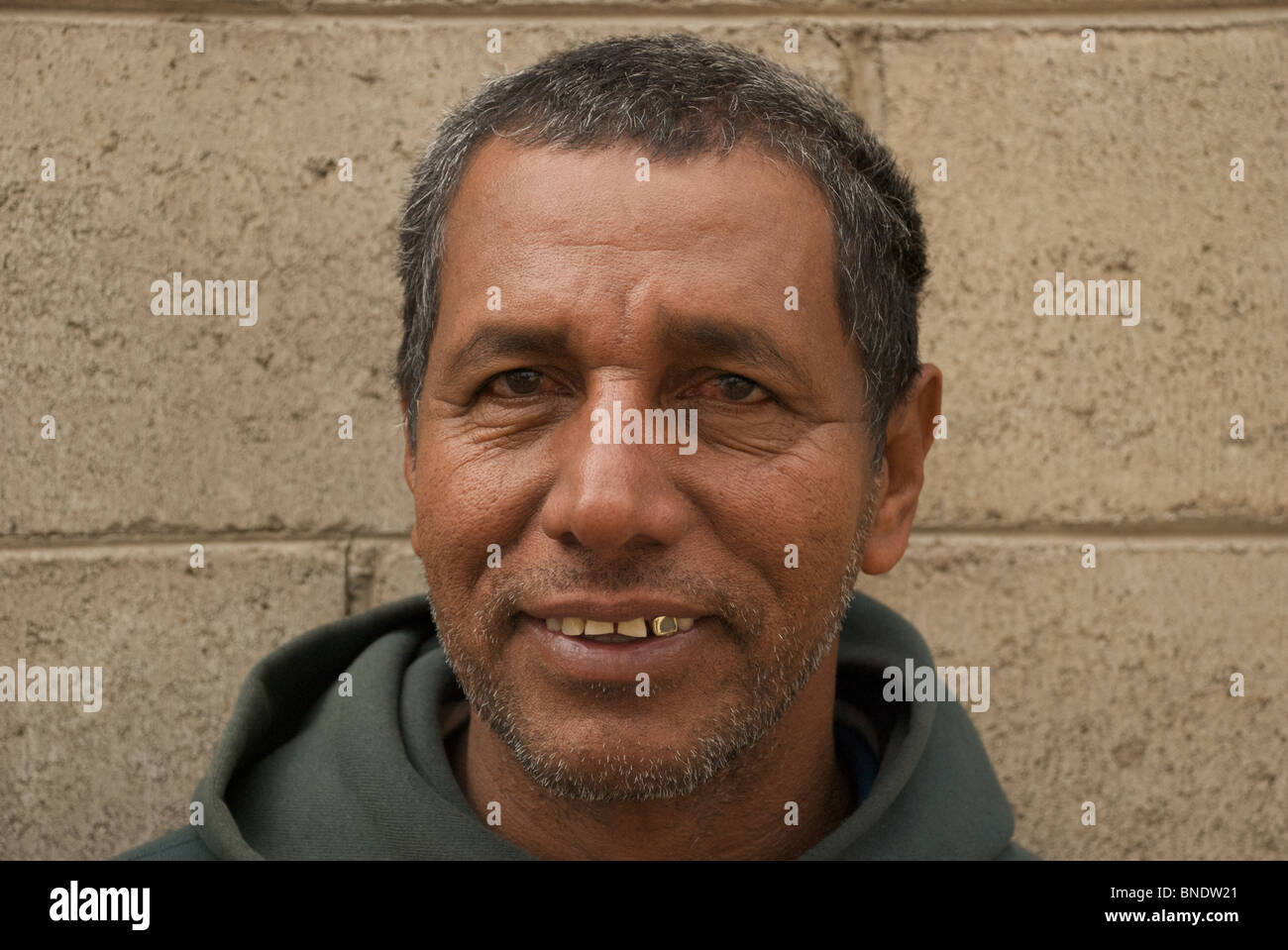 Gold tooth hi-res stock photography and images - Alamy