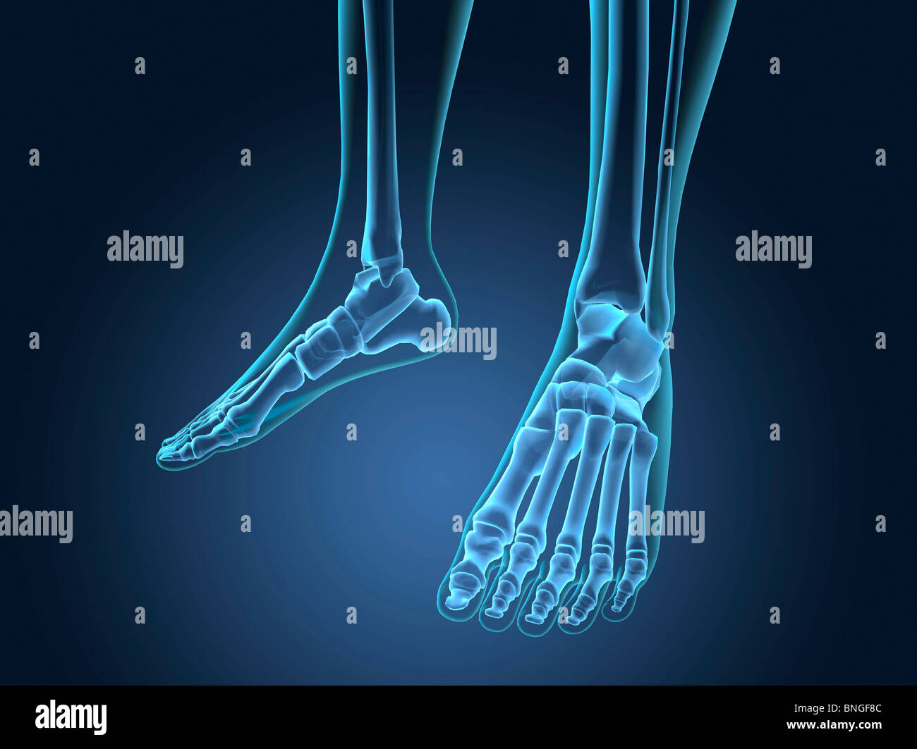 X-ray view of foot bones Stock Photo - Alamy