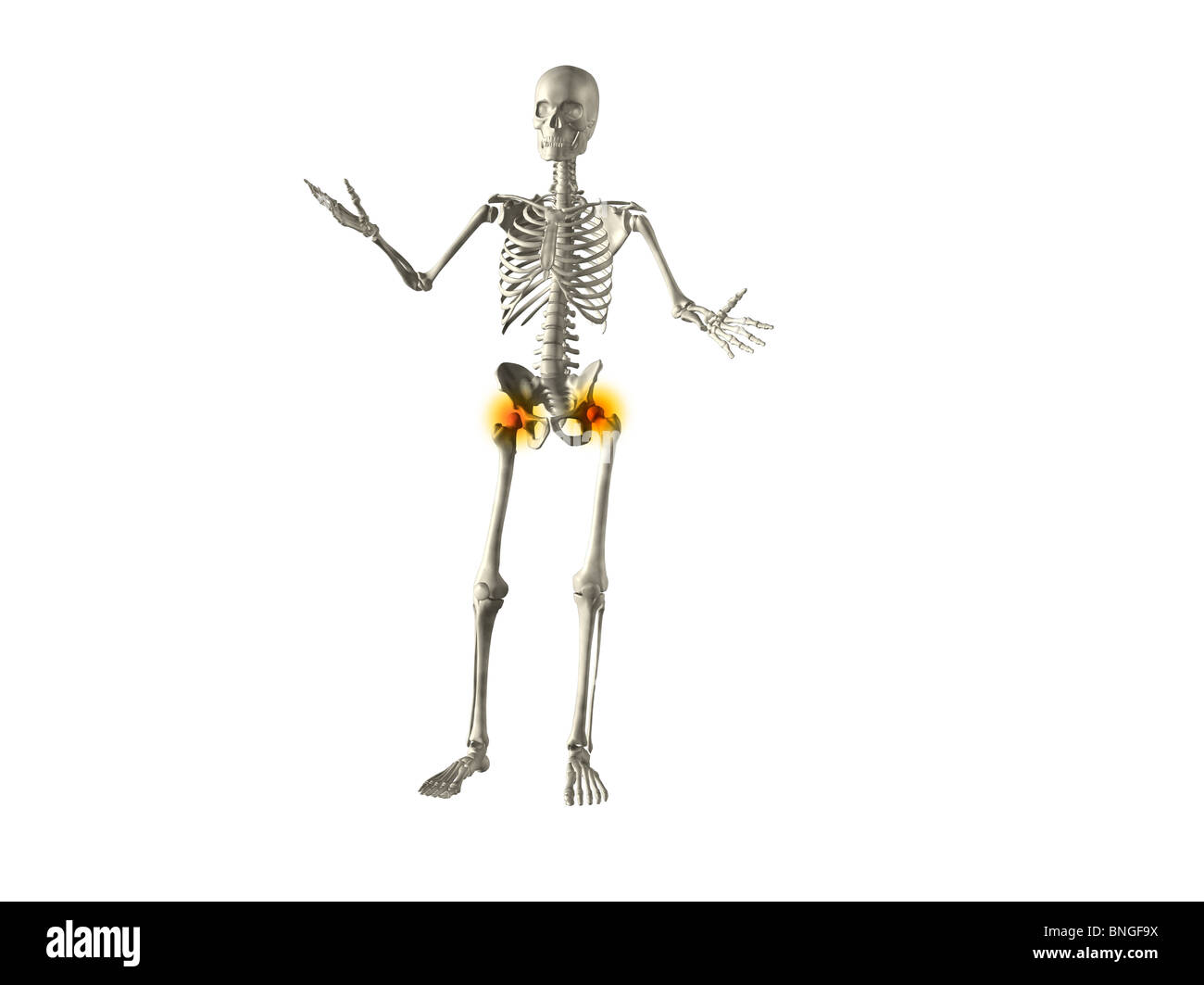 X-ray view of a human skeleton with hip joint inflammation Stock Photo ...