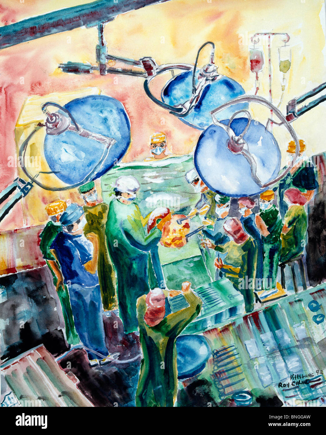 Transplant surgery painting hi-res stock photography and images - Alamy