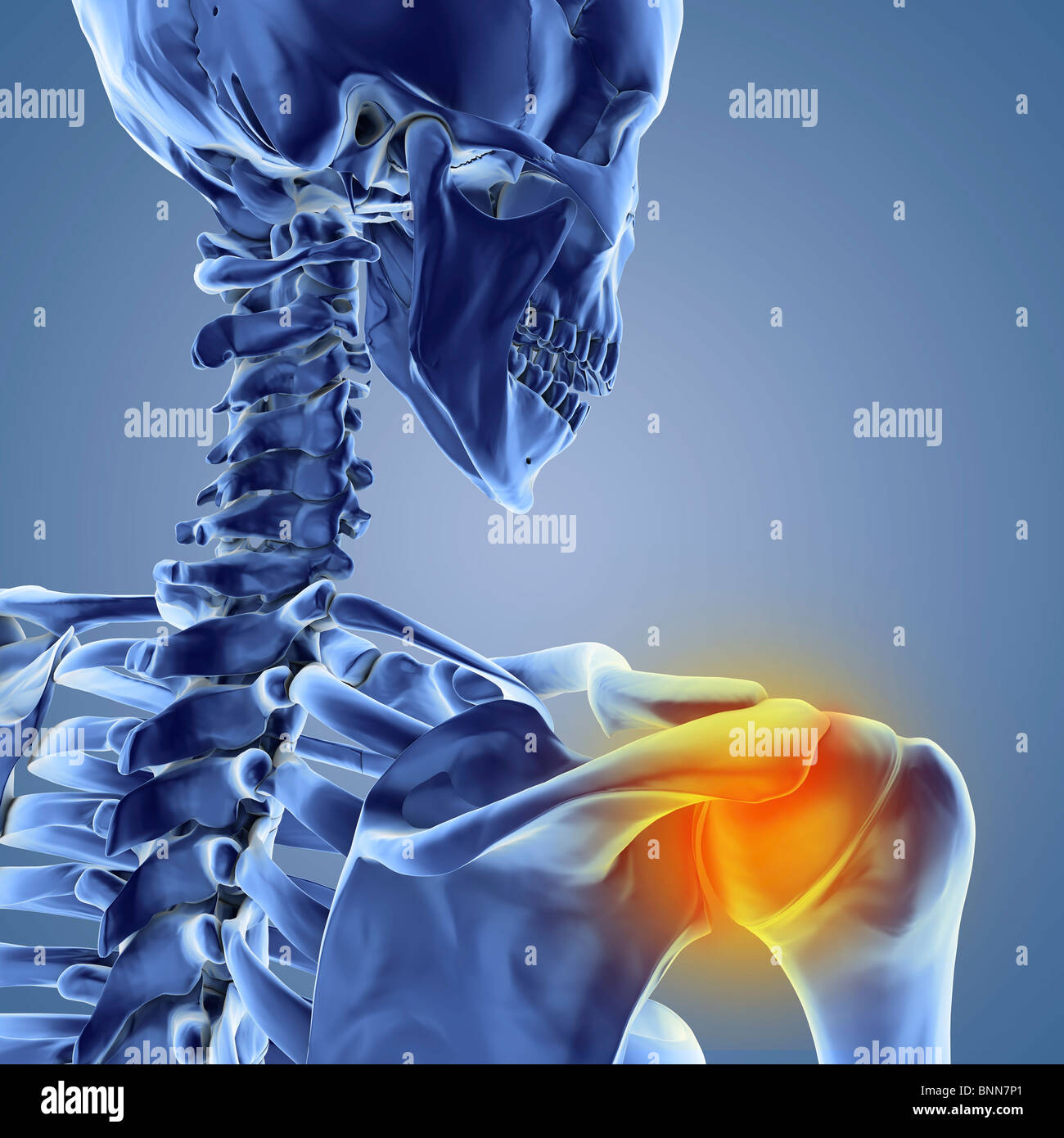 Laptop Shoulder Pain at Brianna Gellatly blog