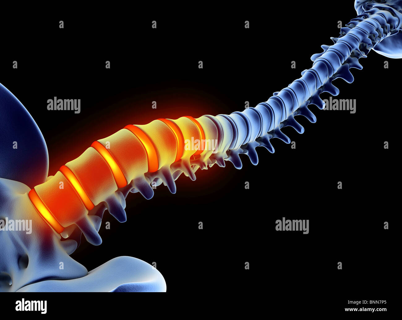 Back pain, computer artwork Stock Photo - Alamy