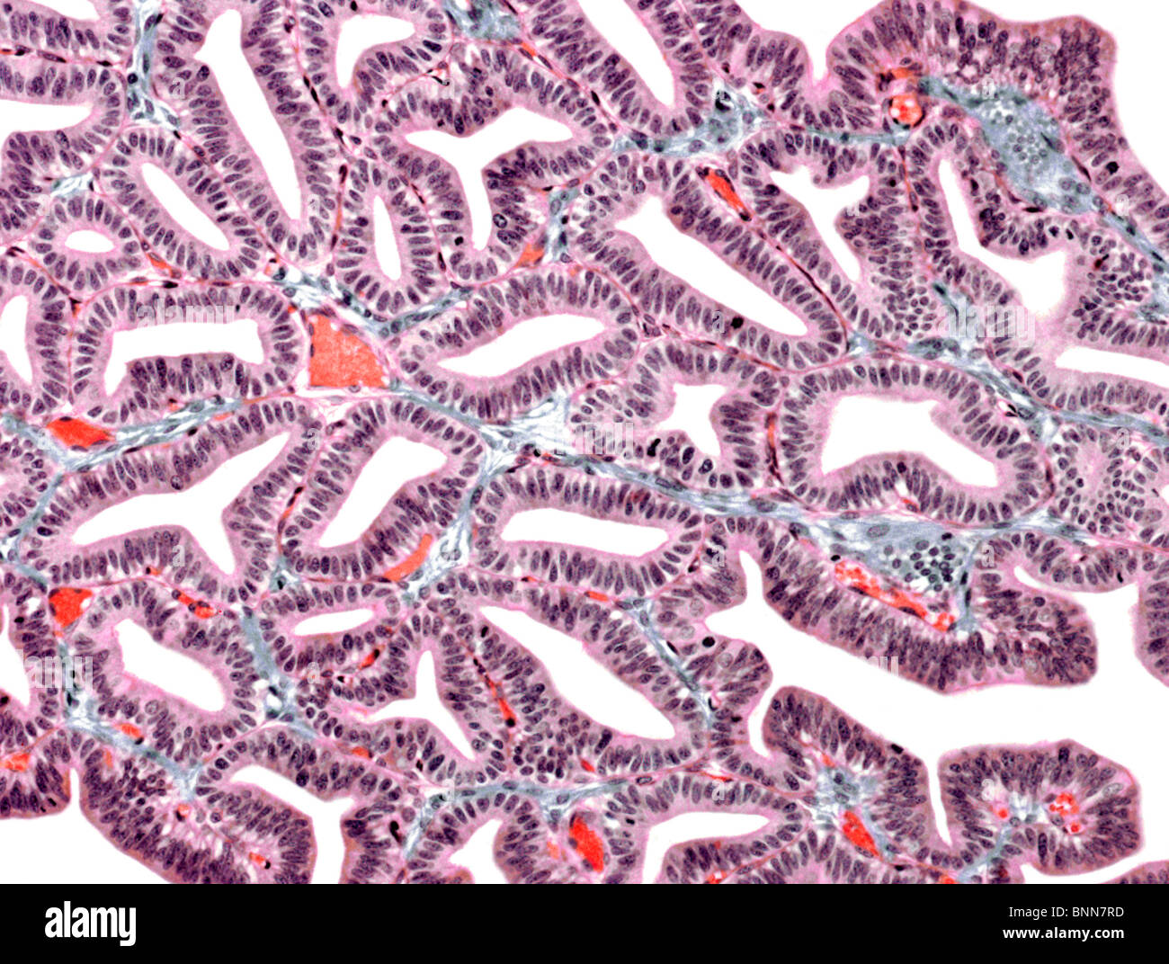 Simple Columnar Epithelium High Resolution Stock Photography and Images ...