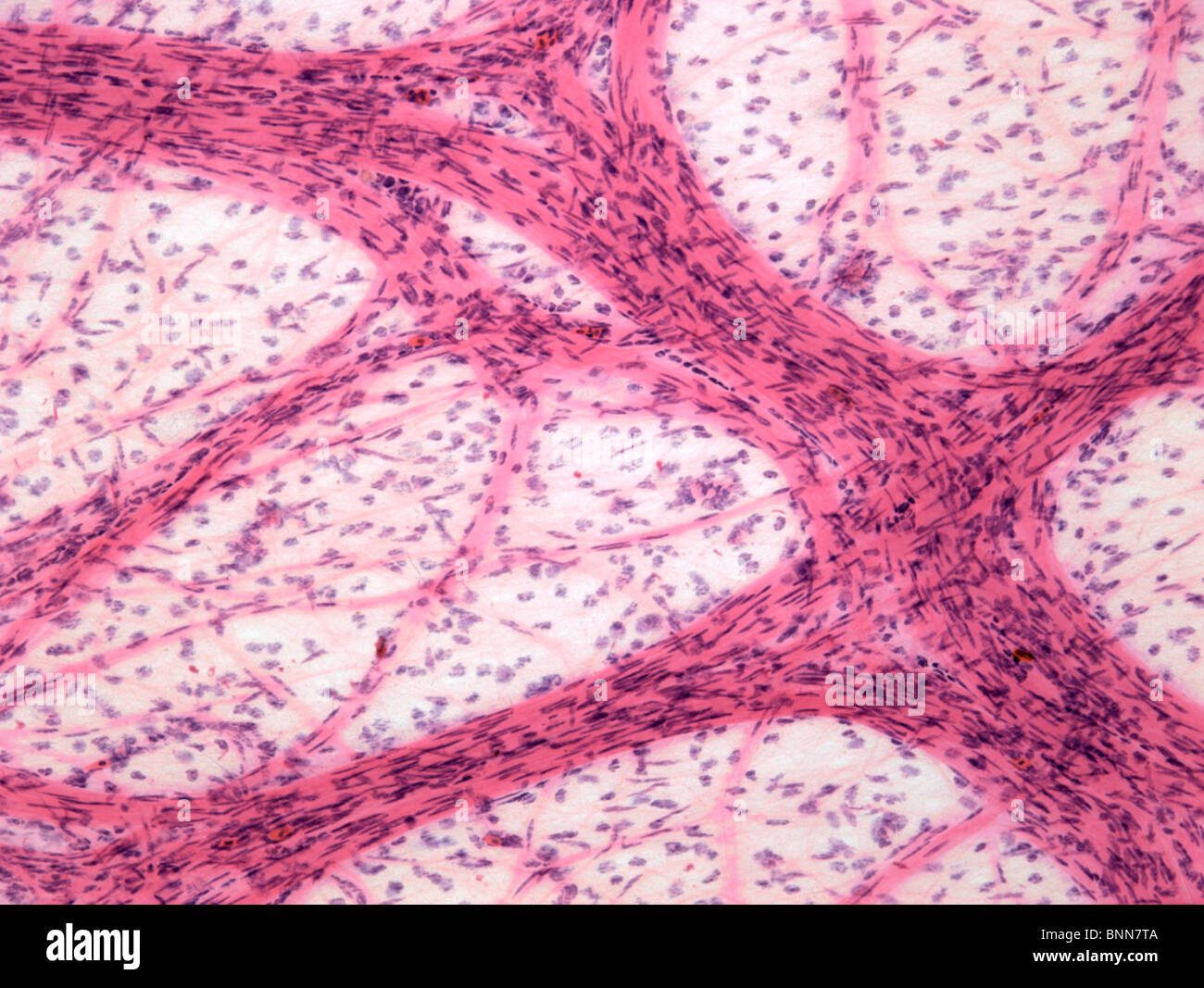 Serous Membrane Histology