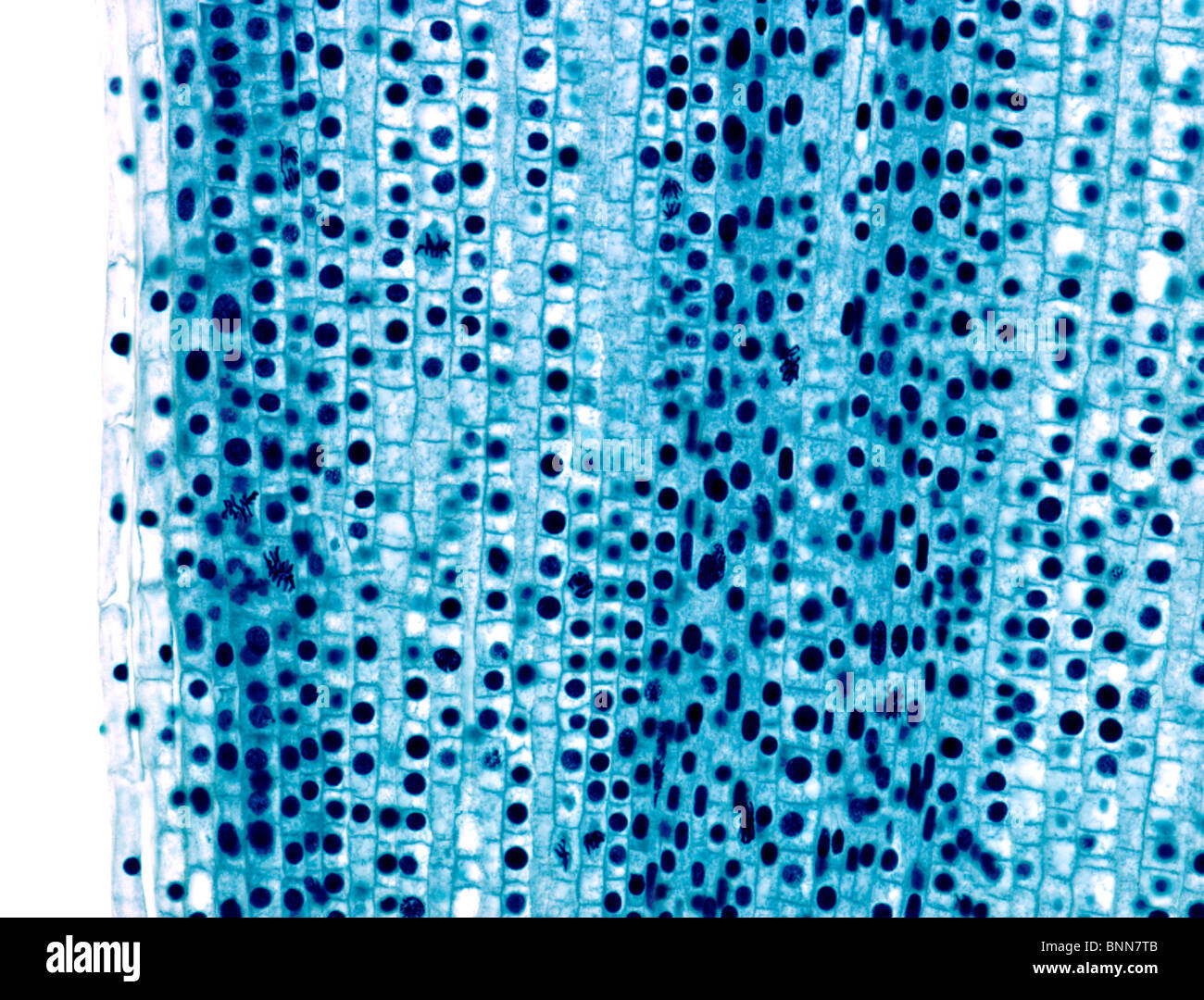 Mitosis, light micrograph Stock Photo - Alamy