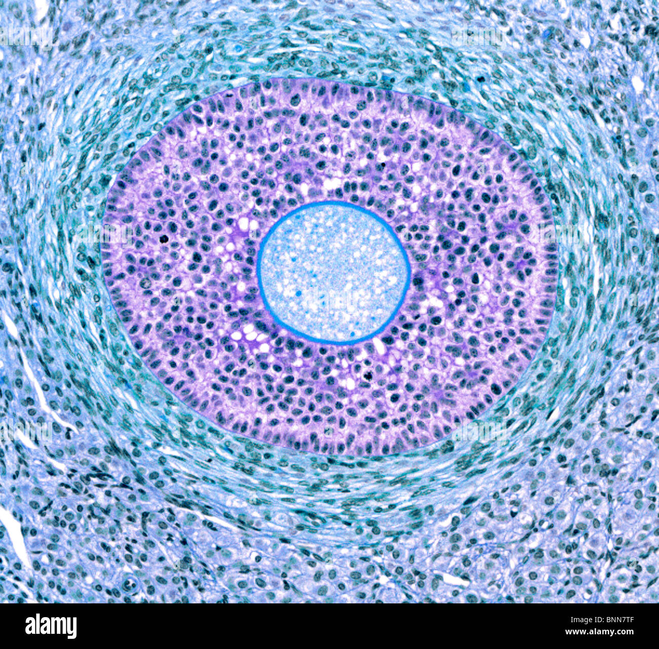 Follicle micrograph hi-res stock photography and images - Alamy