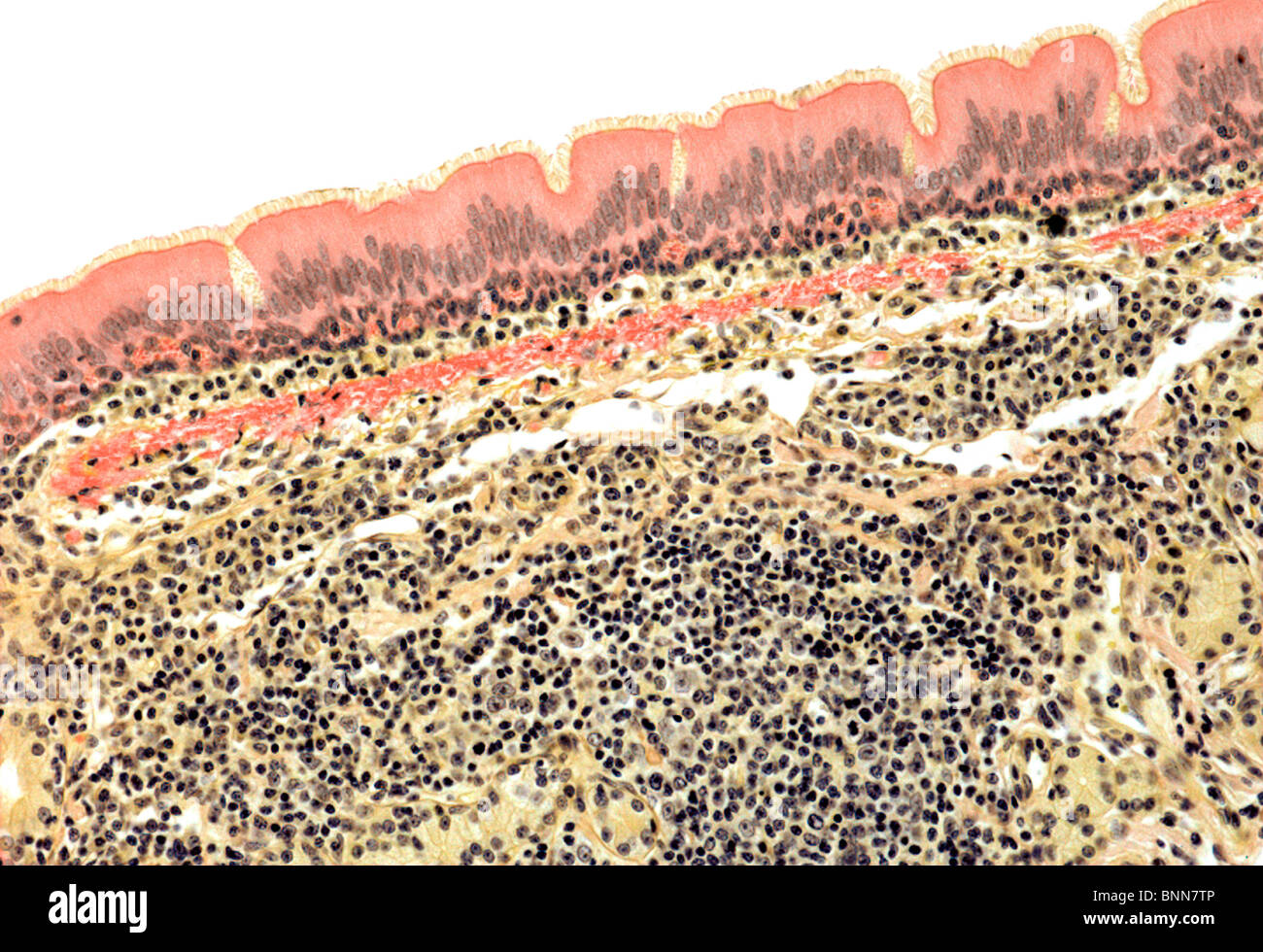 Trachea micrograph hi-res stock photography and images - Alamy