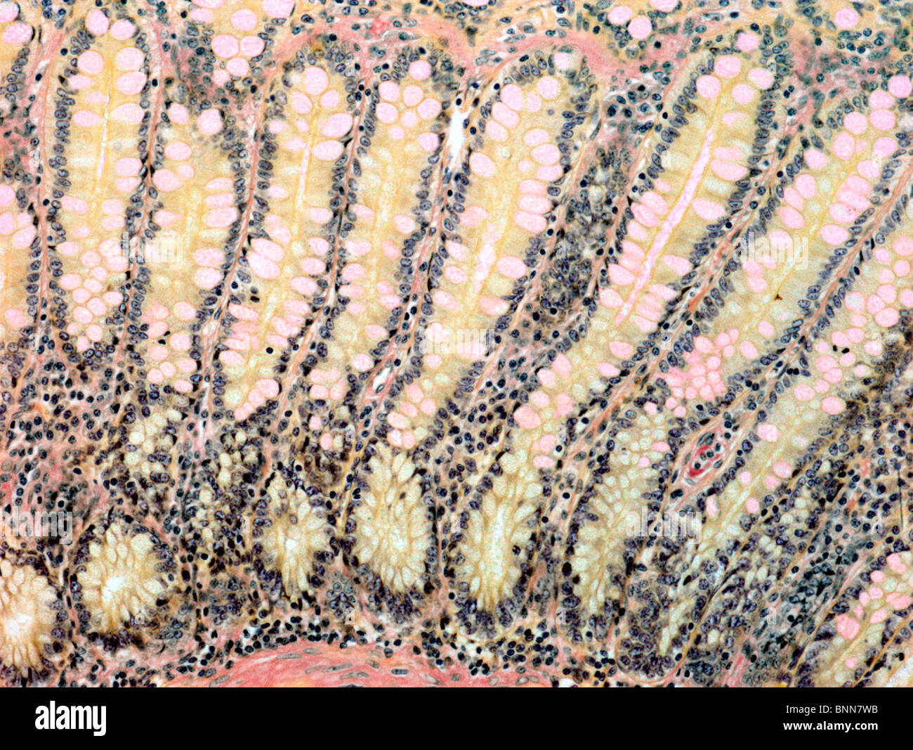 Simple columnar epithelium intestine hi-res stock photography and ...