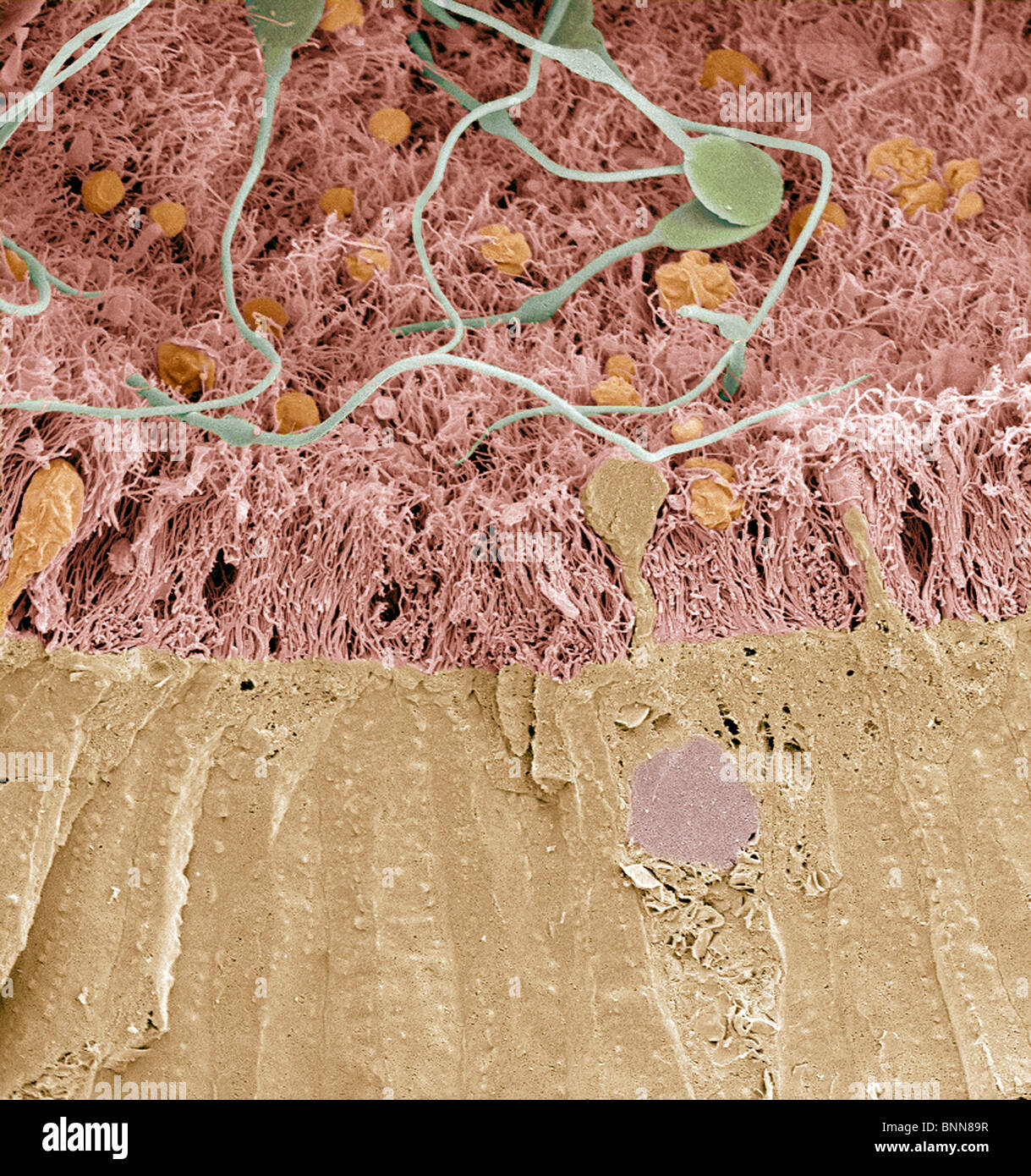 Testis with the epididymis hi-res stock photography and images - Alamy