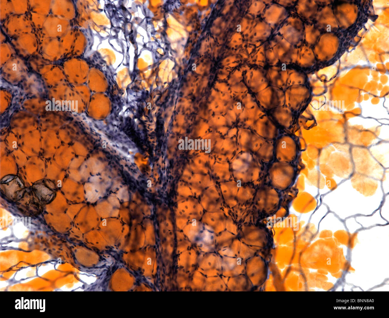 Fat tissue, light micrograph Stock Photo - Alamy