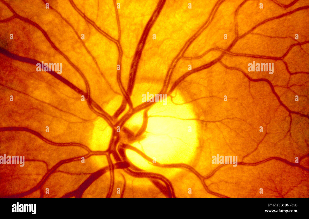 Opthalmascope hi-res stock photography and images - Alamy