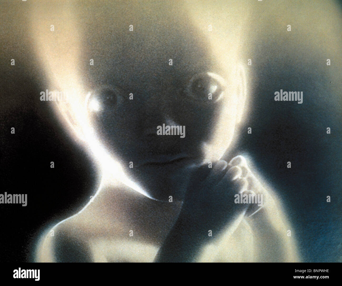 Foetal Stock Photos & Foetal Stock Images - Alamy