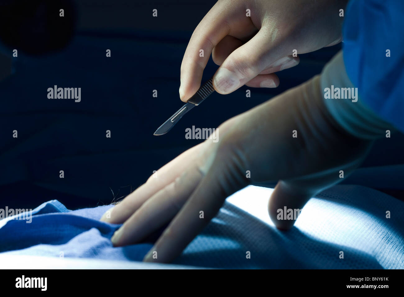Surgery Operation Scalpel High Resolution Stock Photography and Images ...