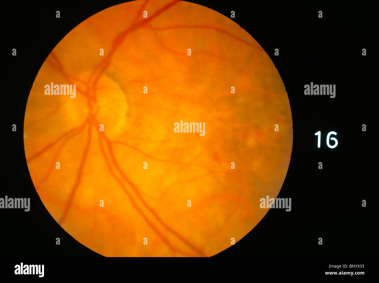 Opthalmascope hi-res stock photography and images - Alamy