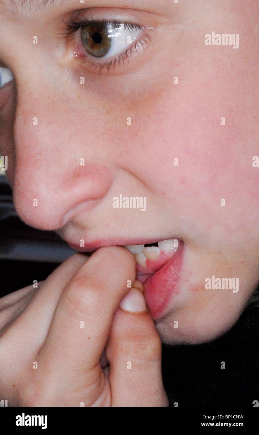 Nail biting child hi-res stock photography and images - Alamy