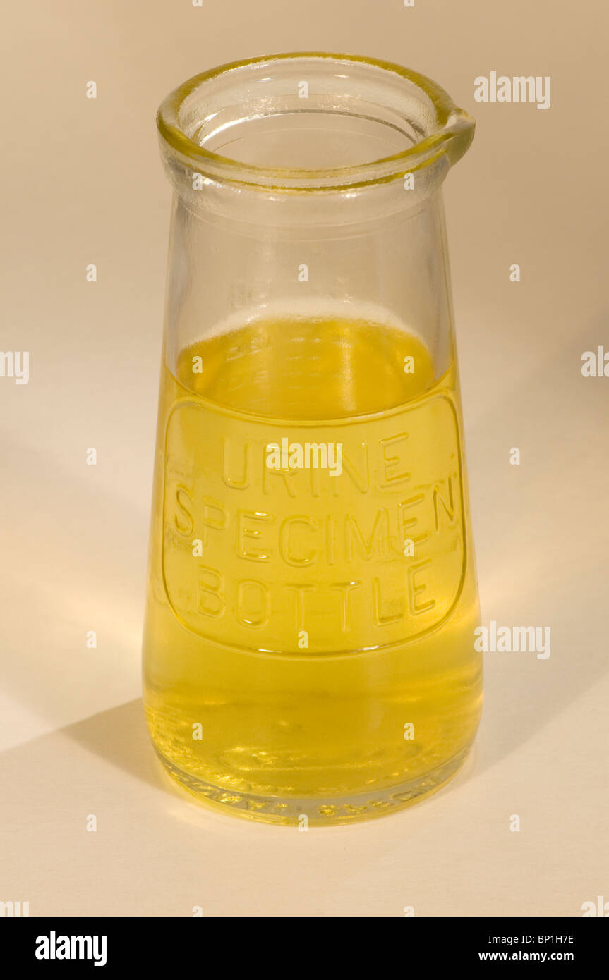 urine specimen jar Stock Photo - Alamy