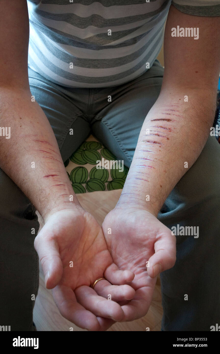 Extremely depressed young man self harming and suicidal Stock Photo - Alamy
