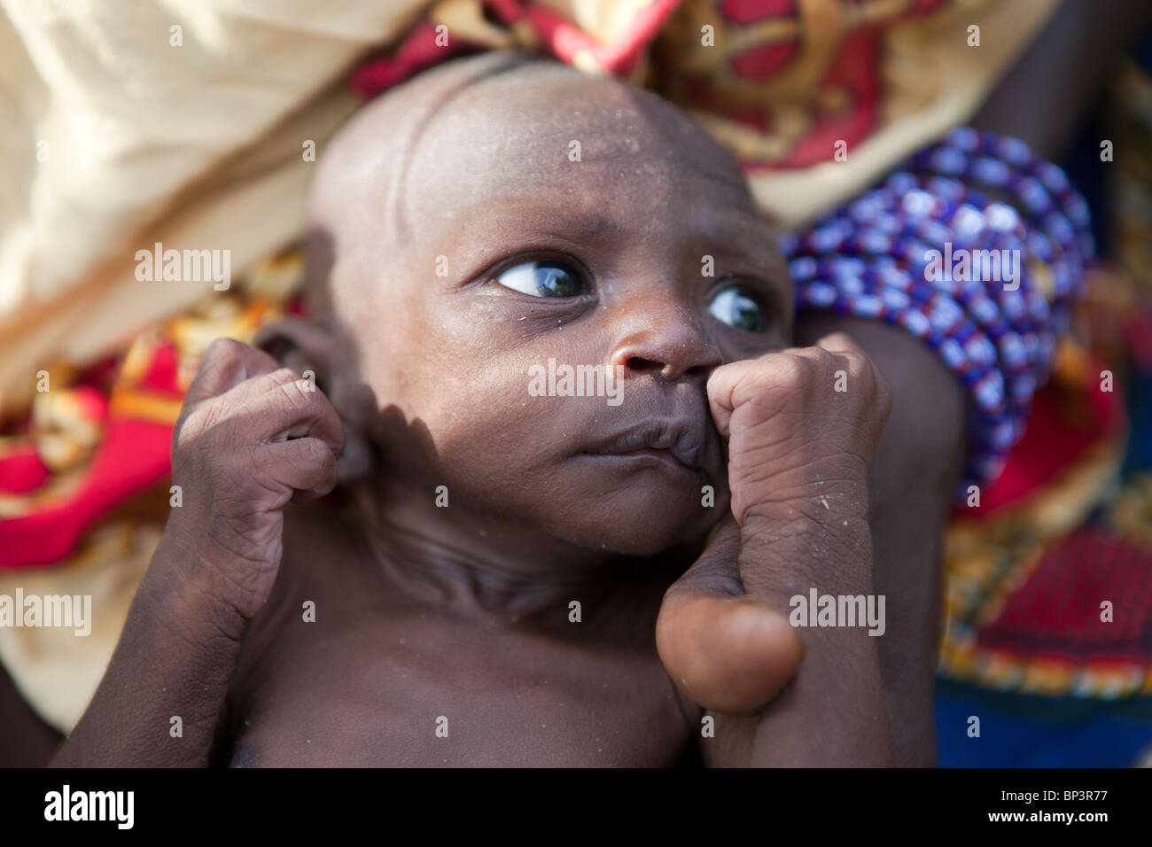 Really Skinny Kids In Africa