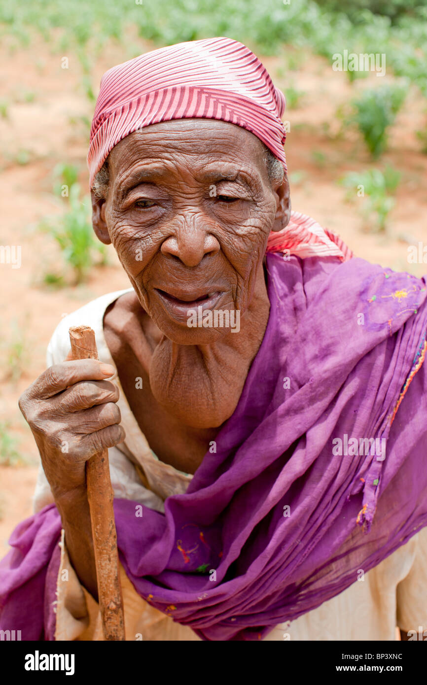 Goiter woman hi-res stock photography and images - Alamy