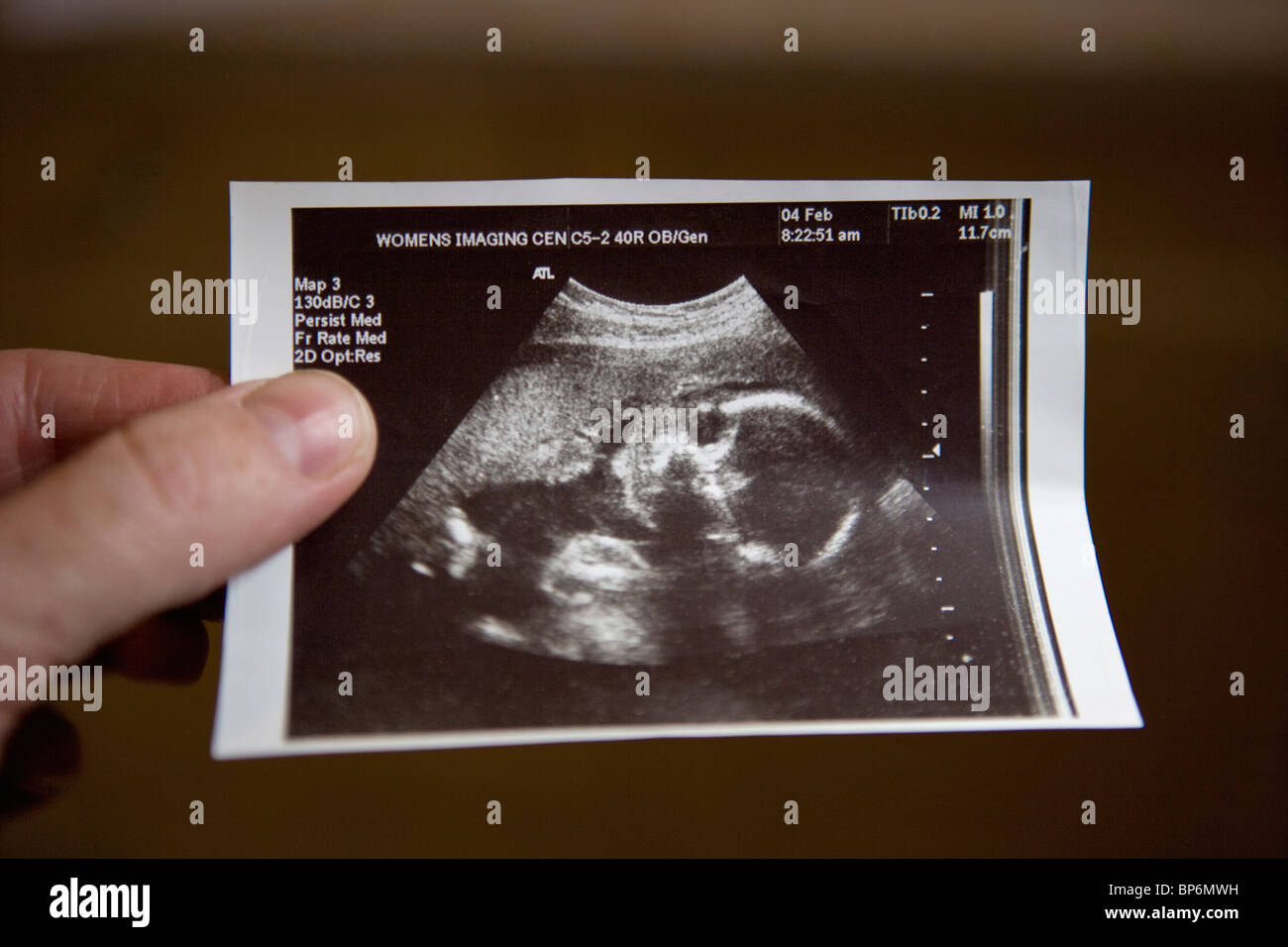 Ultrasound of a human fetus Stock Photo - Alamy