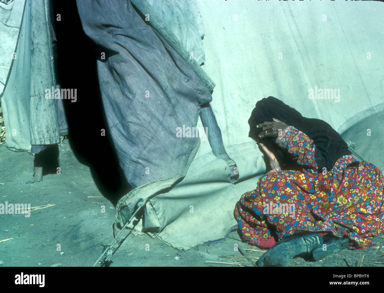 Afghan refugee woman in Pakistan has lost her toes to frostbite Stock ...