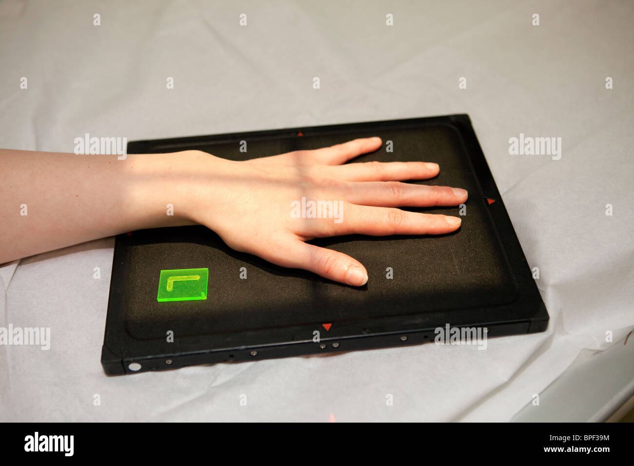 a hand is x-rayed Stock Photo - Alamy