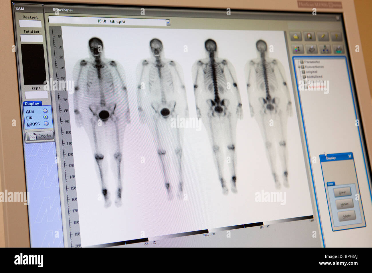 Spect scanner hi-res stock photography and images - Alamy