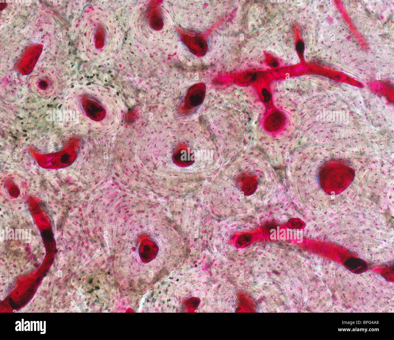 Compact Bone High Resolution Stock Photography and Images - Alamy