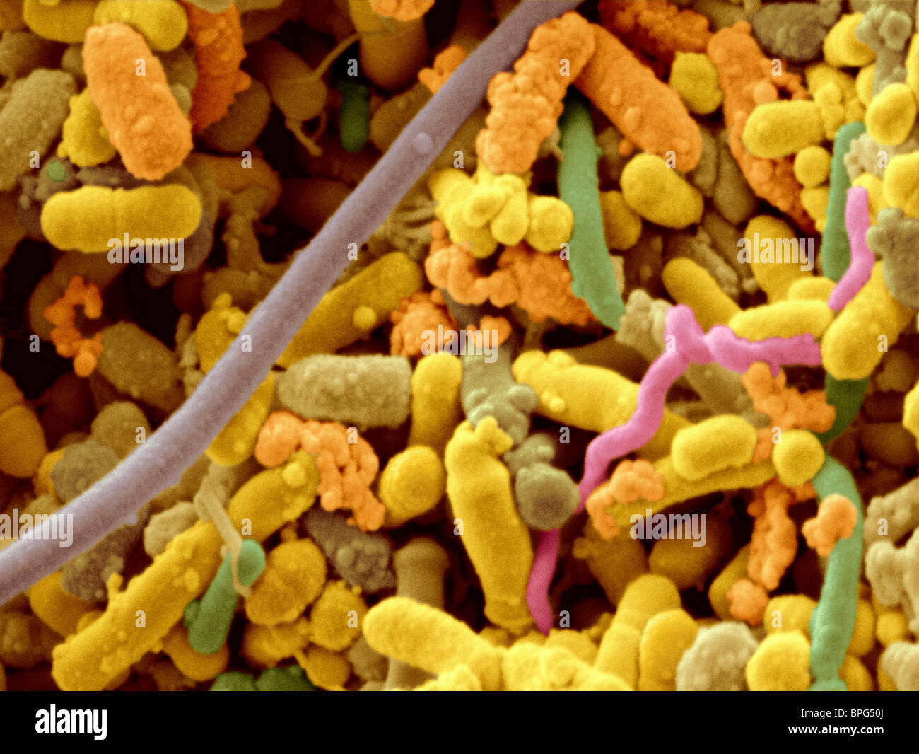 Tonsils micrograph hi-res stock photography and images - Alamy
