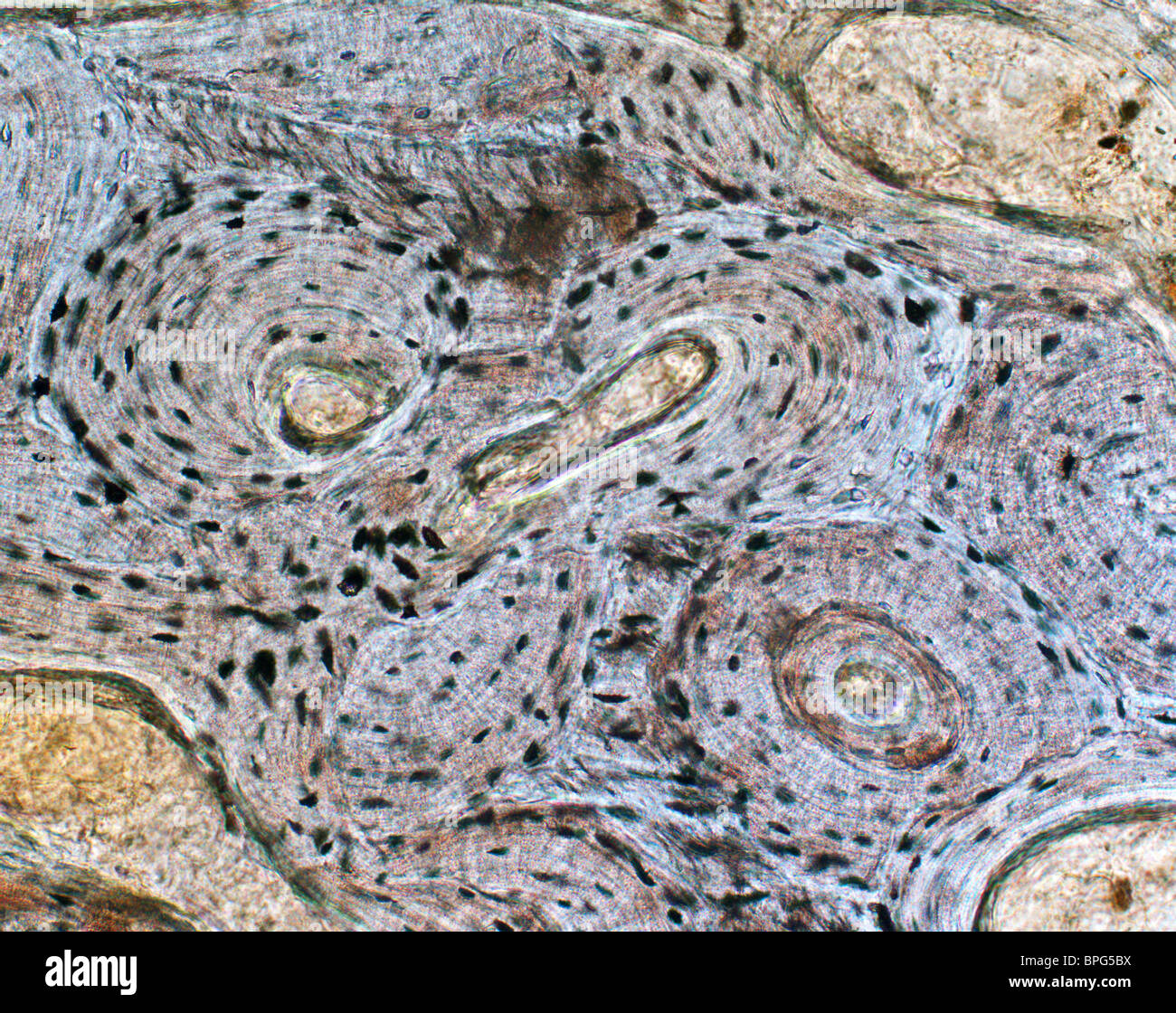 A light micrograph of bone showing the concentric lamellae which ...