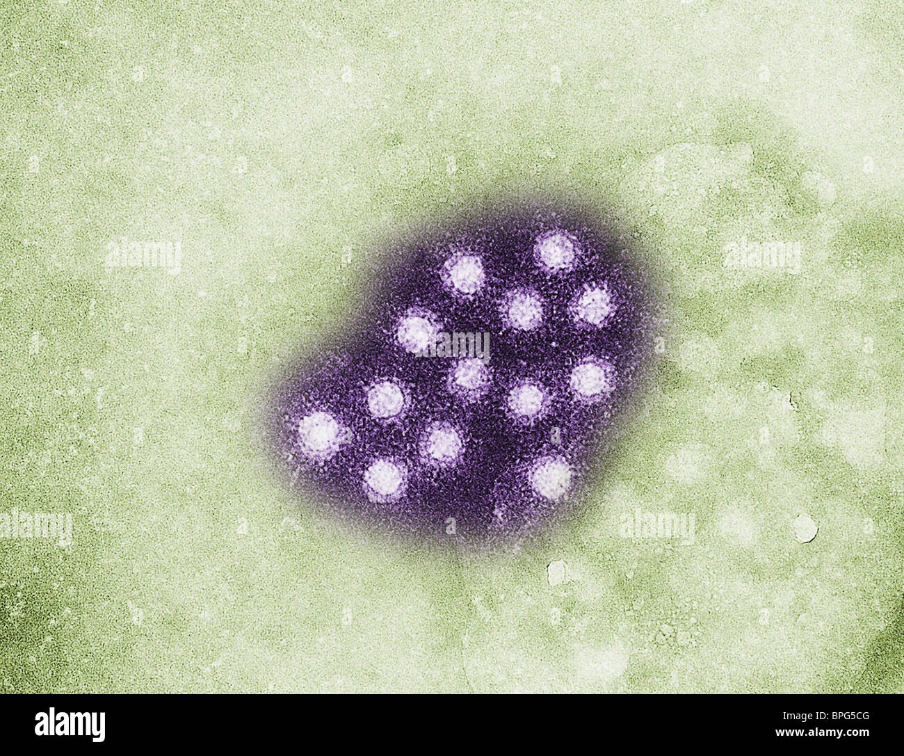 TEM - hepatitis A virus Stock Photo - Alamy