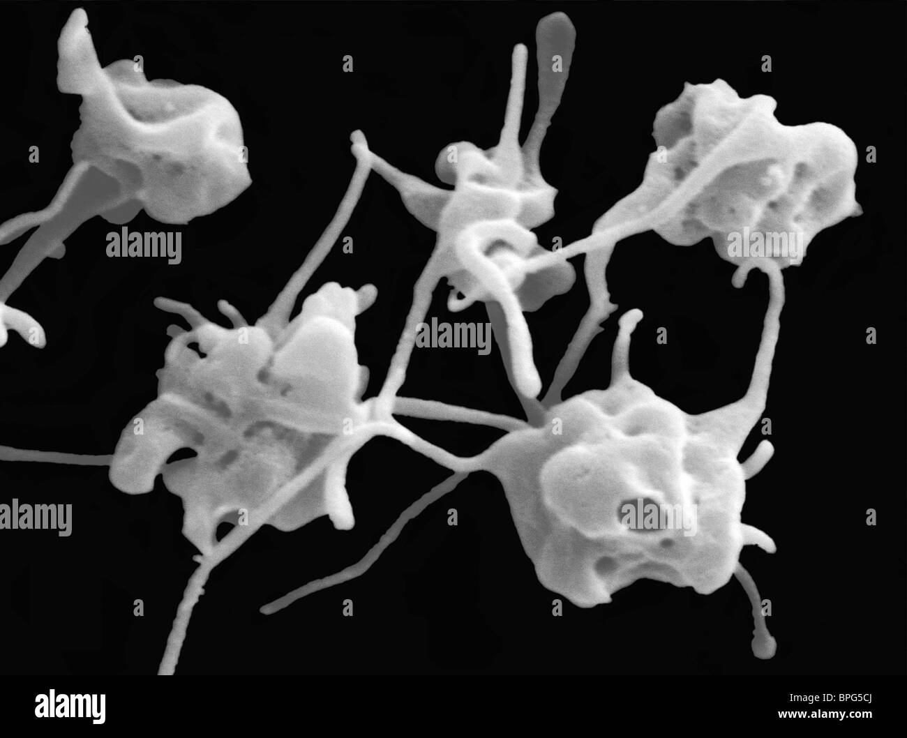 Platelets in their activated state in human blood Stock Photo - Alamy