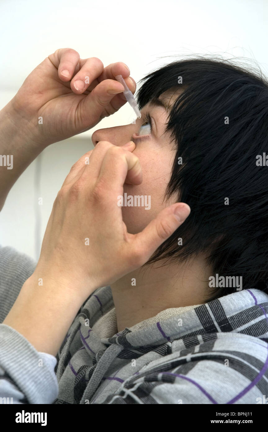 Patient applying eye drops herself Stock Photo - Alamy