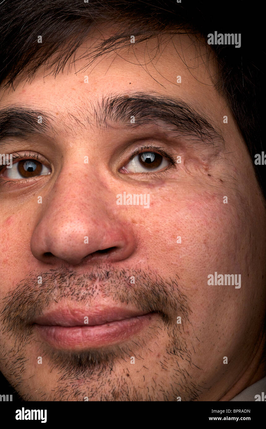 Portrait of a wounded Iraq veterans face Stock Photo - Alamy