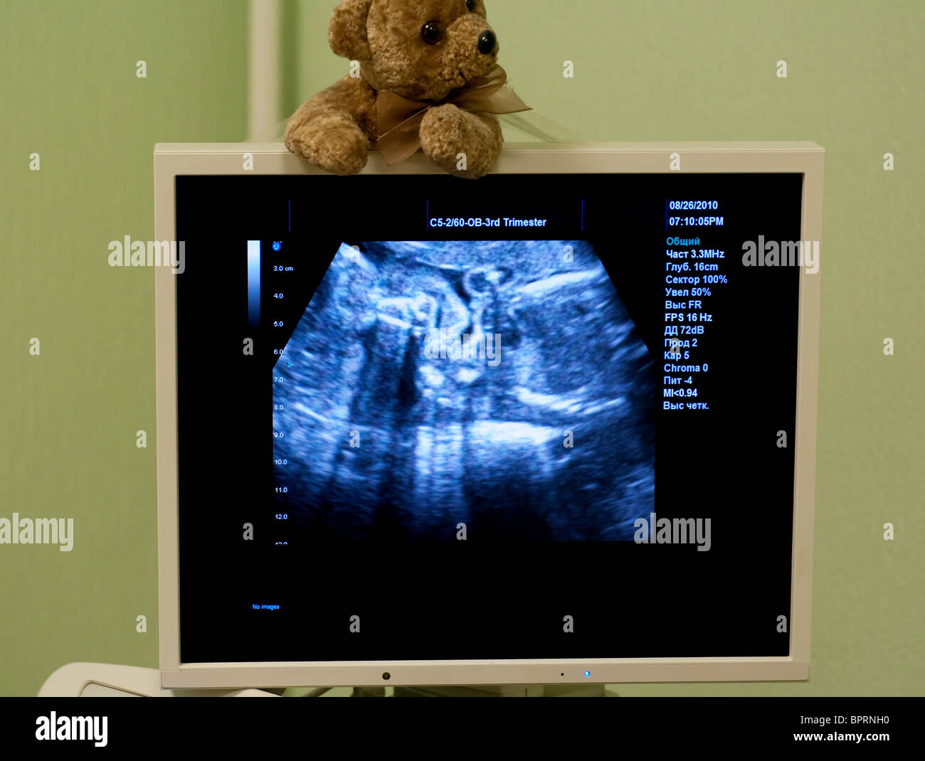 Obstetrician examining pregnant belly by ultrasonic scan Stock Photo ...