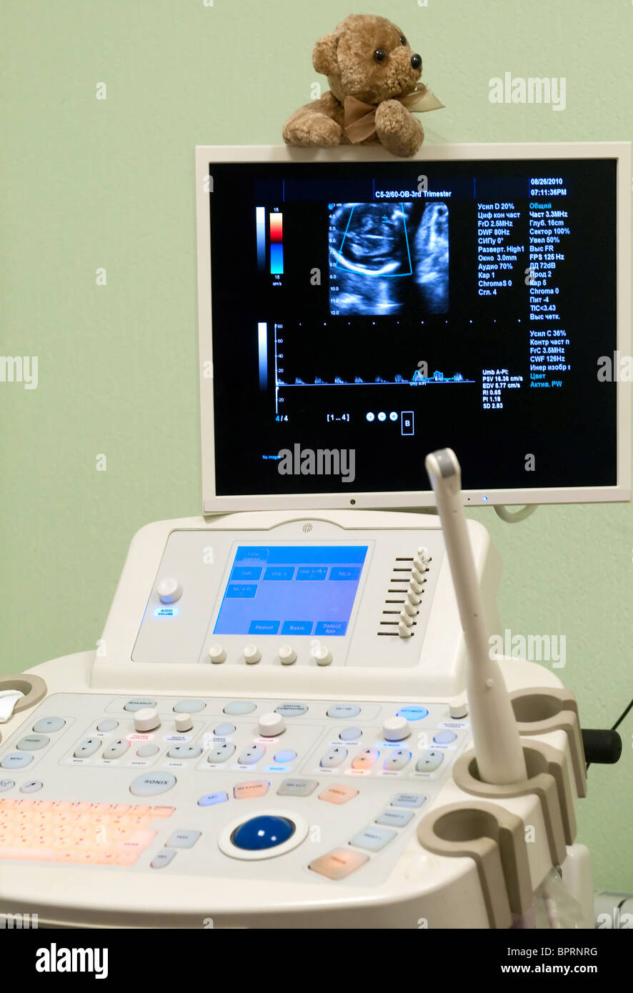 Medical Equipment ultrasound scanning. Diagnosis of pregnancy Stock ...