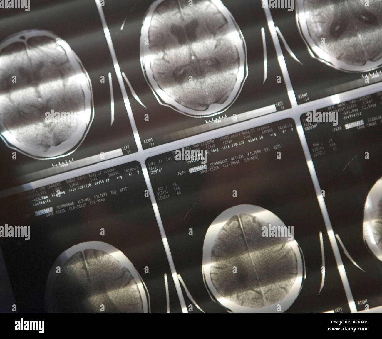 MRI head scans Stock Photo - Alamy