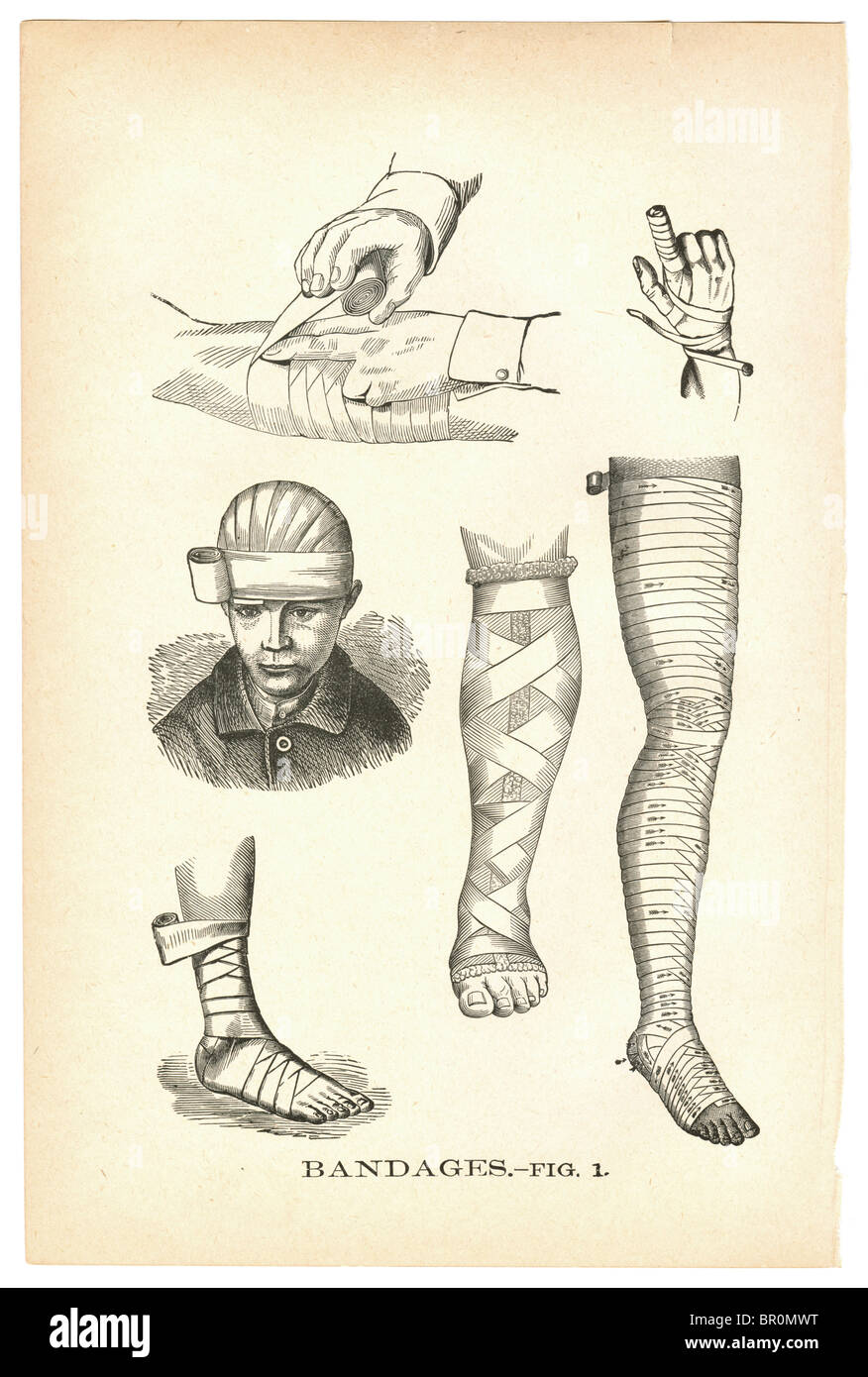 Medical Illustration History Hand High Resolution Stock Photography and ...